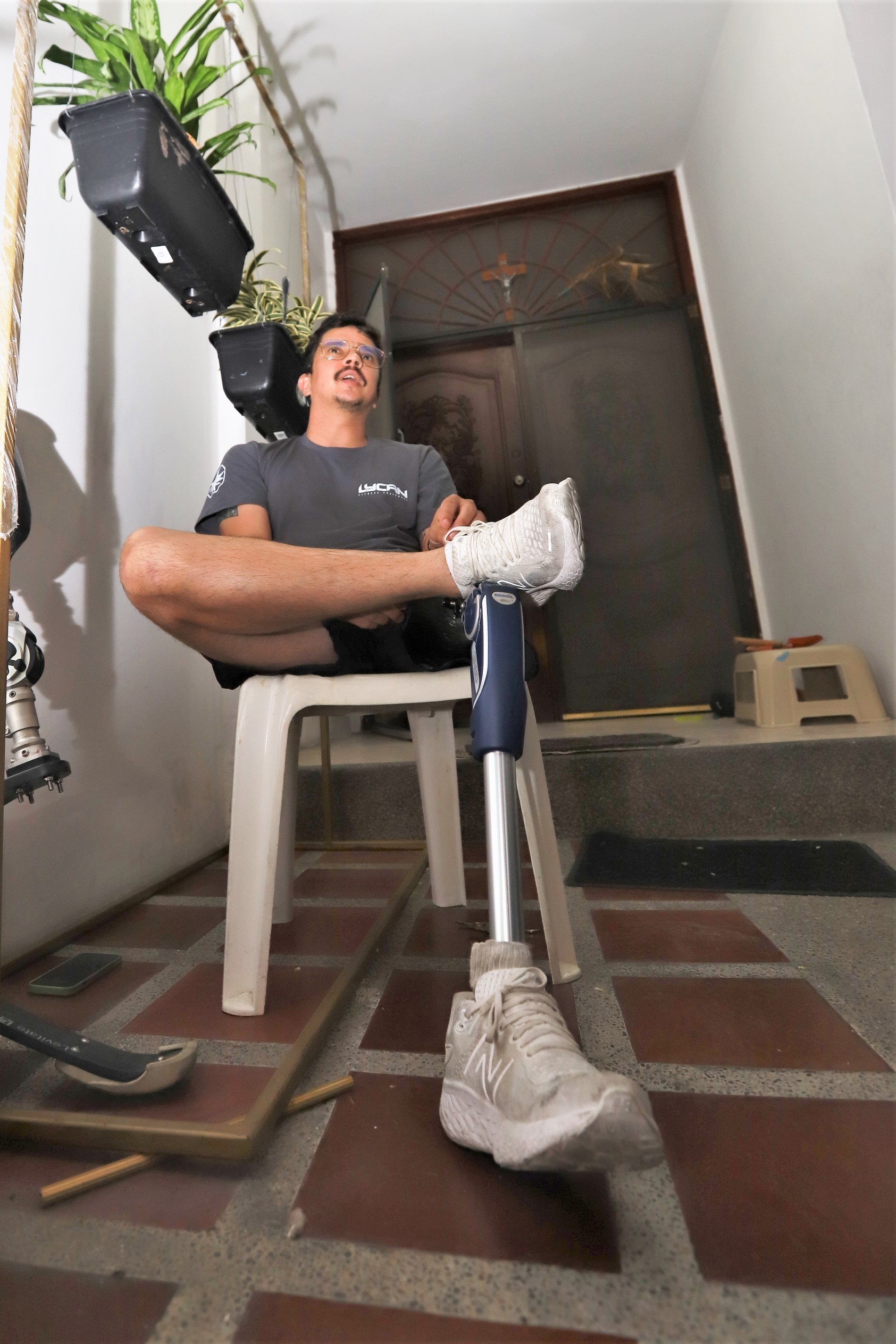 ¡Sin prótesis y sin esperanza! Pacientes amputados no consiguen ...