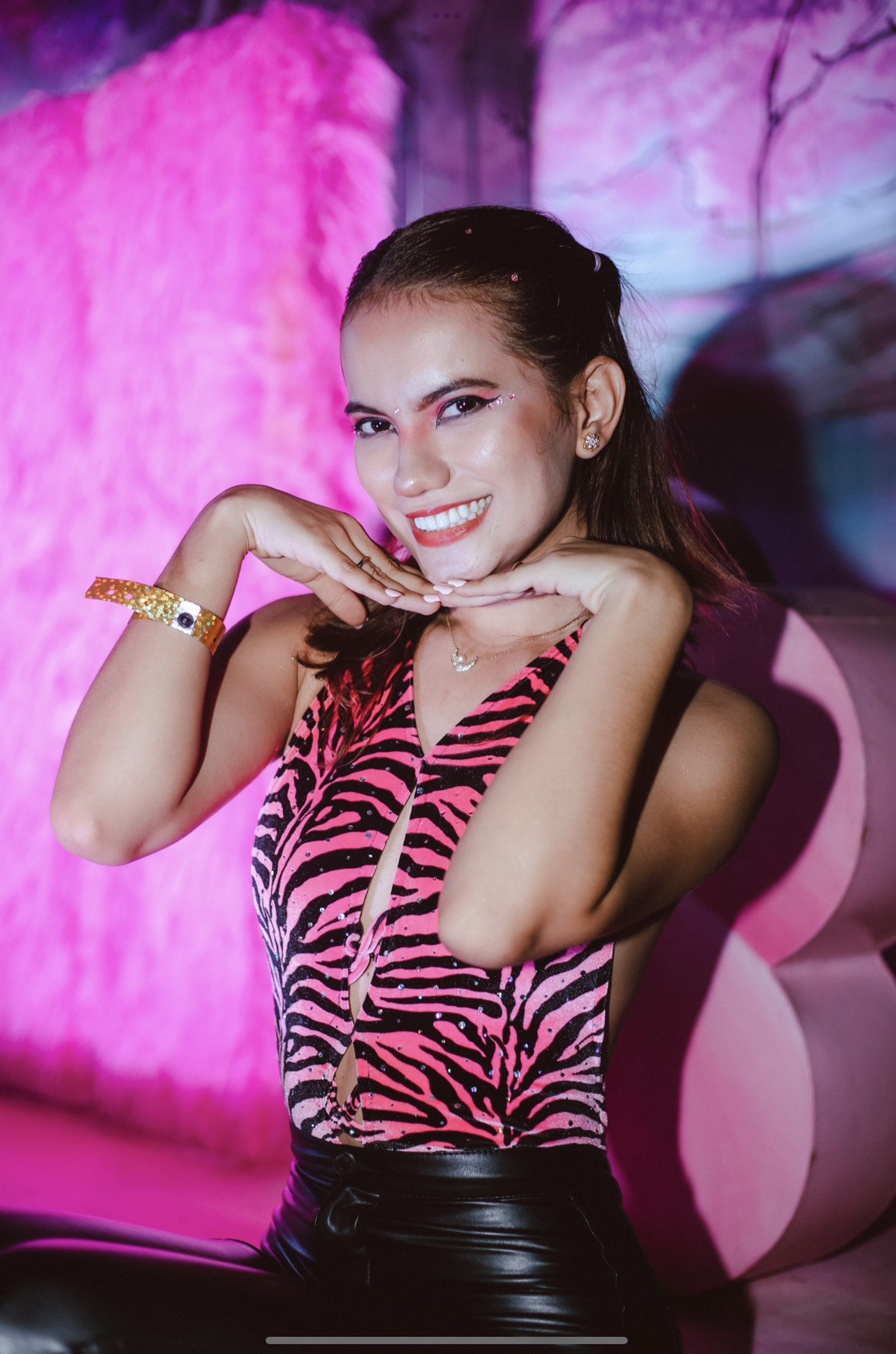 Allison Romero superó la depresión que le provocó la agresión en su rostro