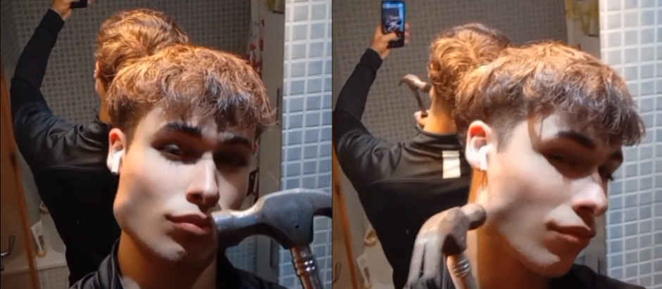 Bone smashing: el peligroso reto viral de pegarse martillazos en la ...