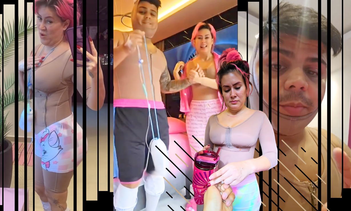 Zully Guillén y su esposo se realizaron cirugías estéticas juntos